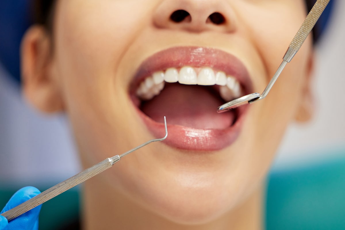 Is a Full Arch Dental Restoration Right for You? - Dental Implant ...